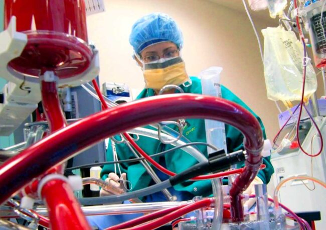 Perfusion - Epic Cardiovascular Services